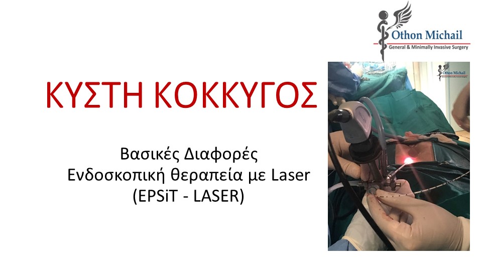 Όθων Π. Μιχαήλ | Γενικός Χειρουργός - Κύστη κόκκυγος: Διαφορές ...
